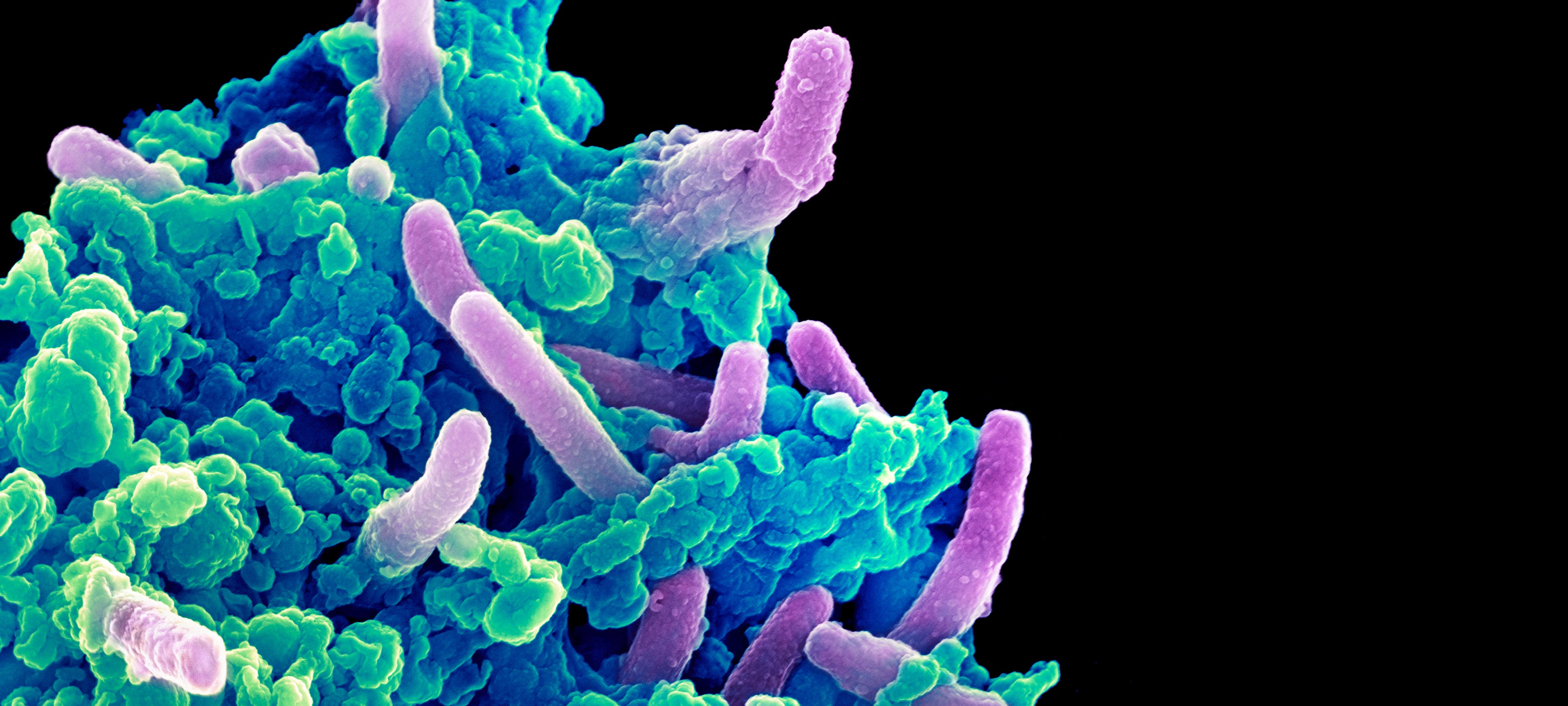 TB is changing. So is science. : Seek