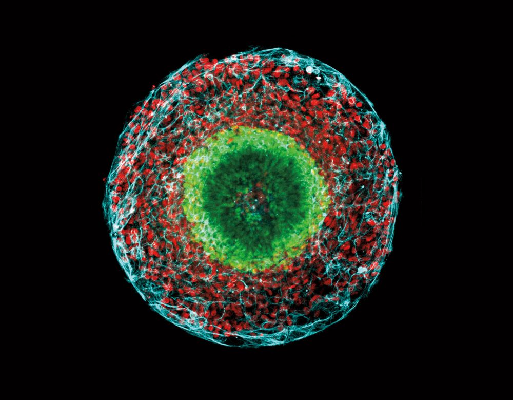 Fat, miscalibrated : Seek