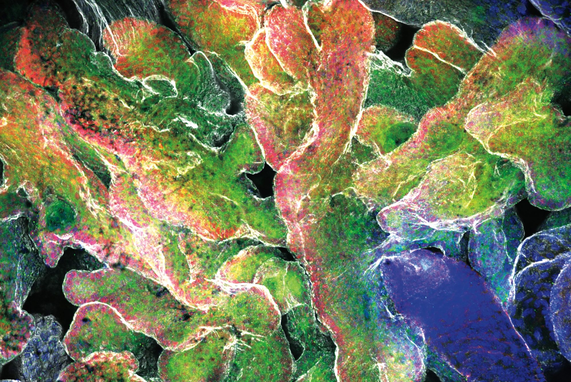 Robin Chemers Neustein Laboratory of Mammalian Cell Biology and ...