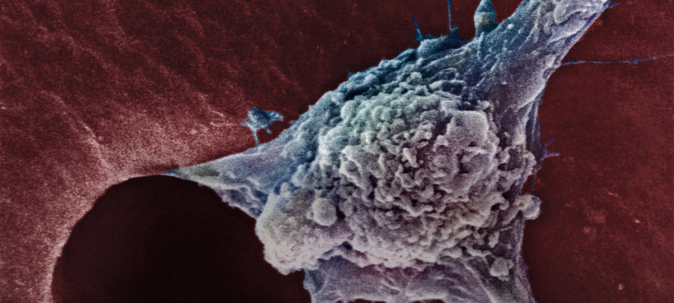 One cell in 10,000 : Seek