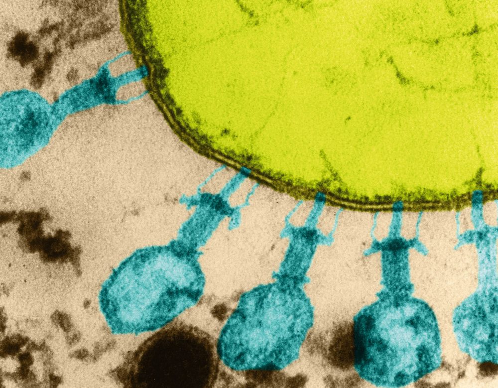 The brain on quarantine : Seek