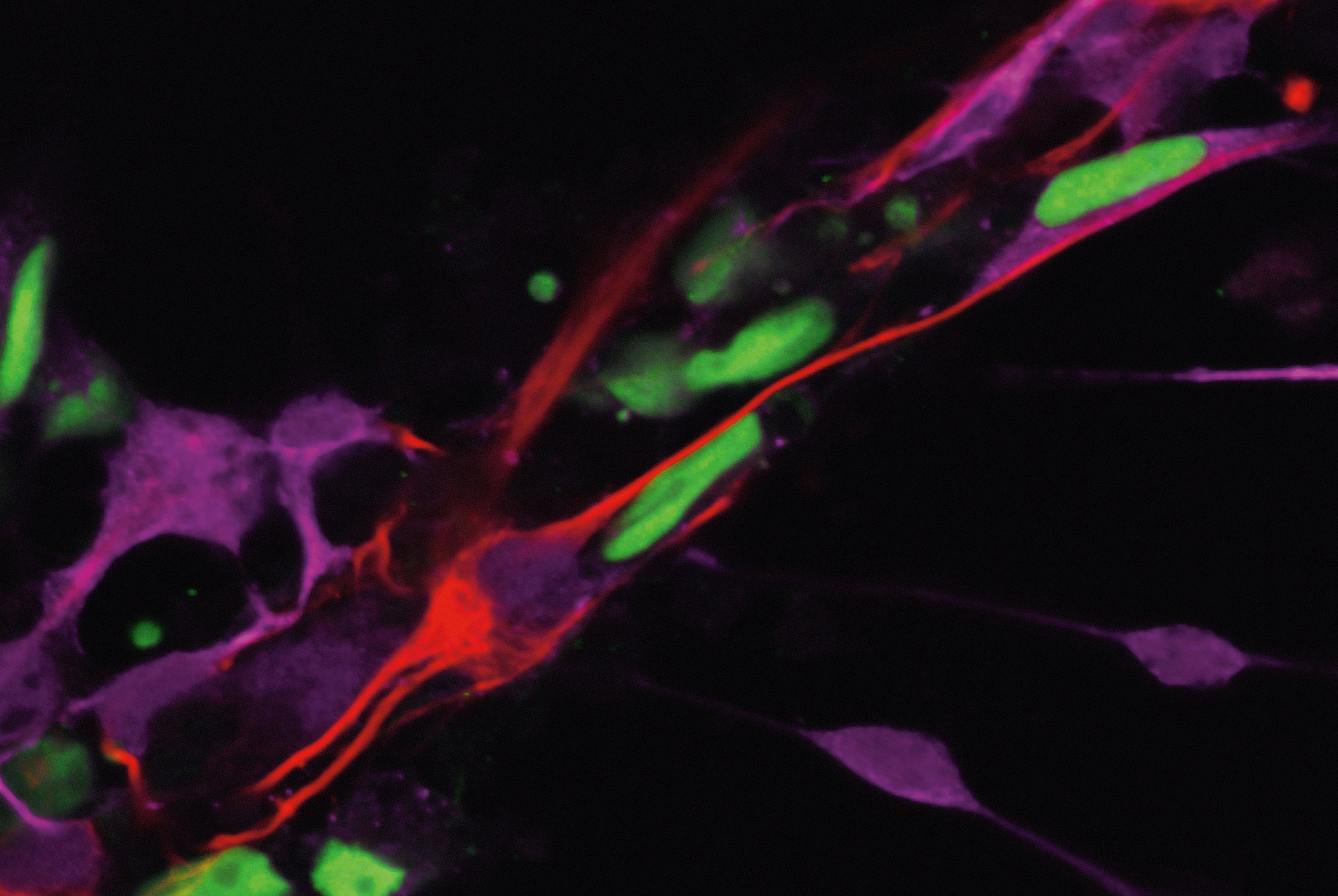 Journey to the cerebellar cortex : Seek