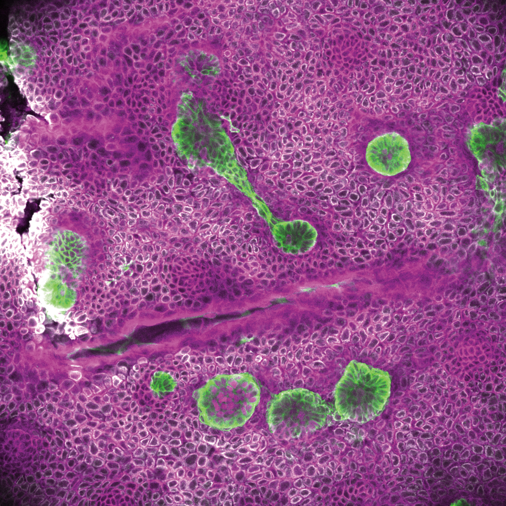 Stem Cells Are Growing Up : Seek