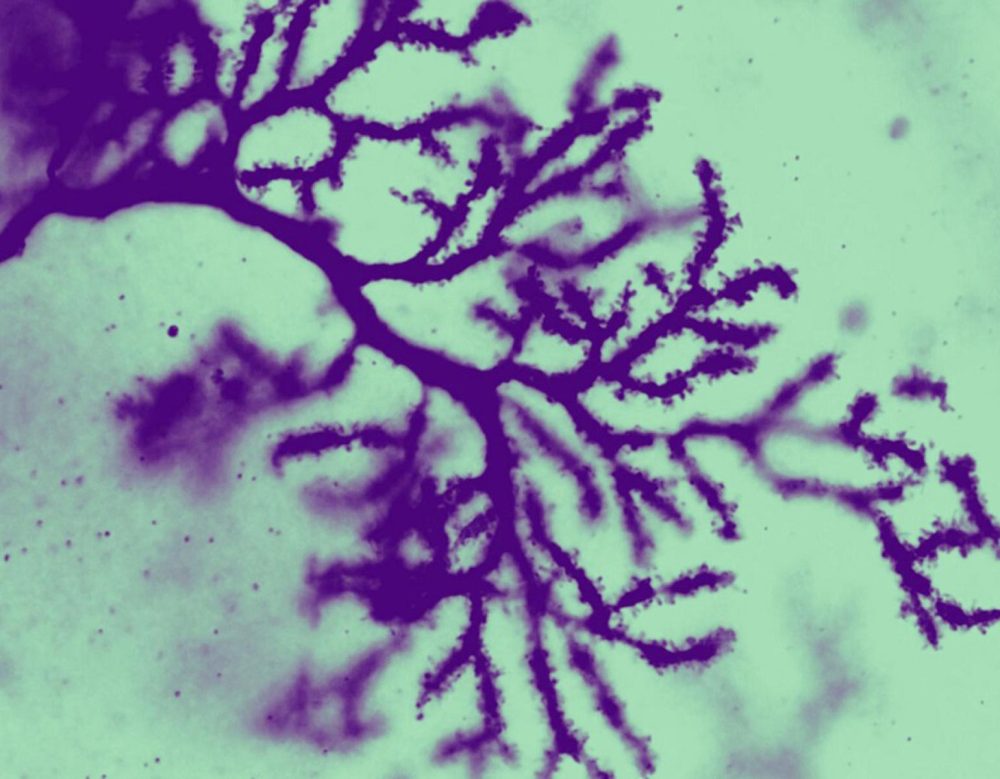 How a key gene contributes to autism : Seek